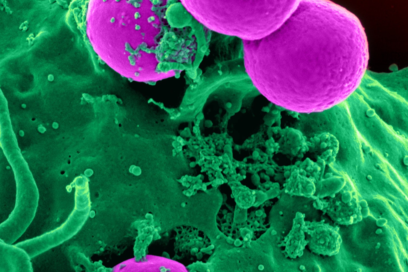 Circular Economy: Sustainable colors with biotechnology and bacteria ...